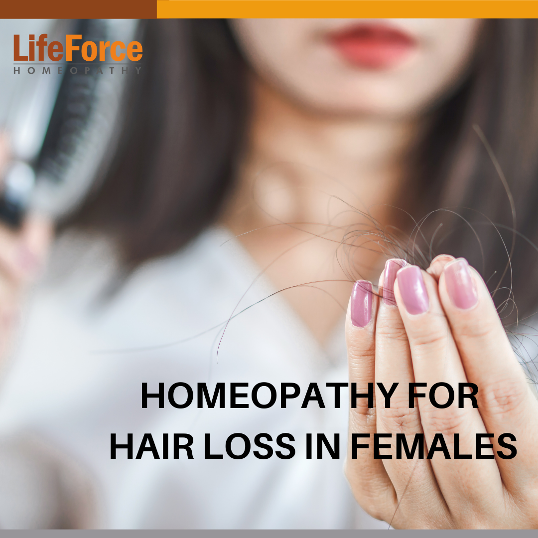 Homeopathy For Hair Loss In Females