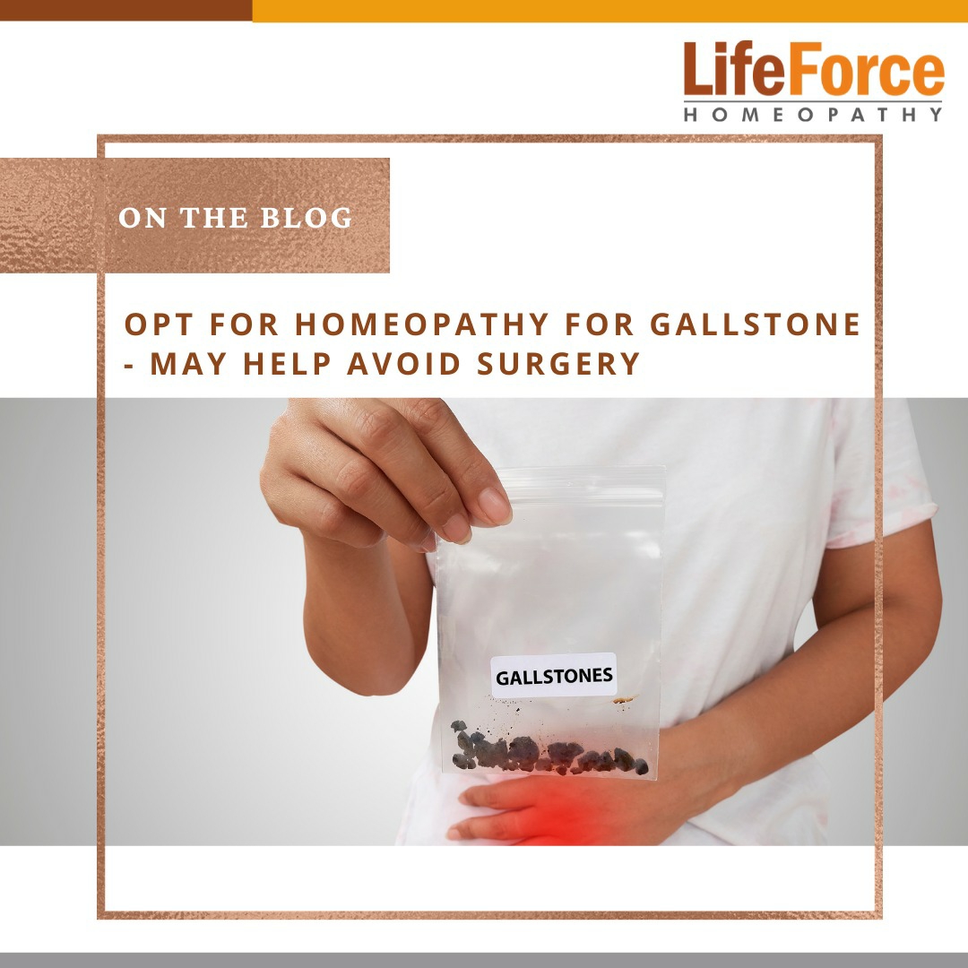 Homeopathy Treatment for Gallstone Without Surgery at Life Force