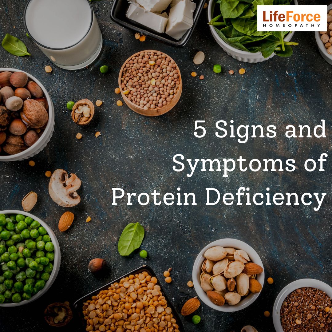 5 Signs and Symptoms of Protein Deficiency