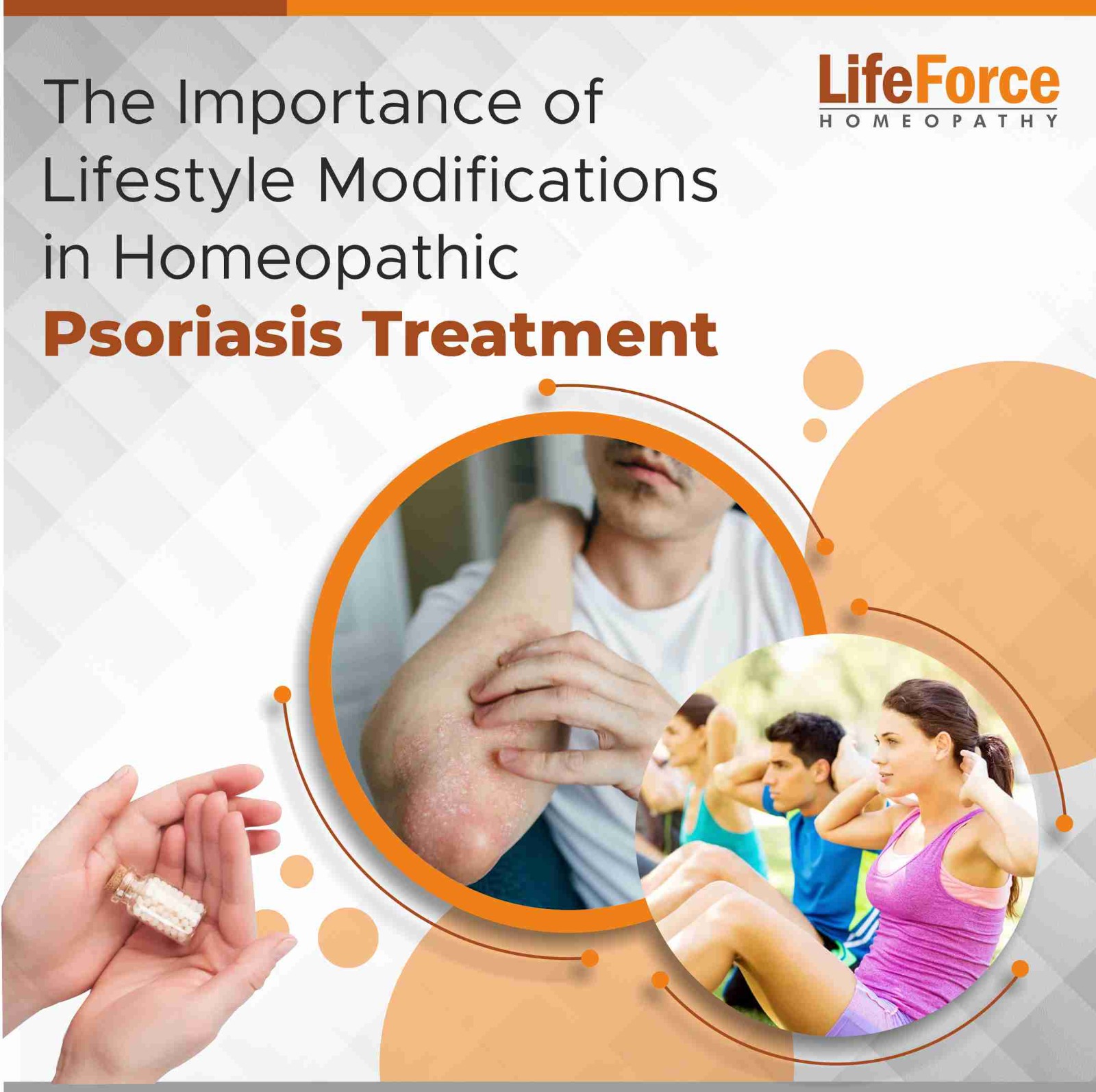 Psoriasis Treatment: Importance of Lifestyle Modification