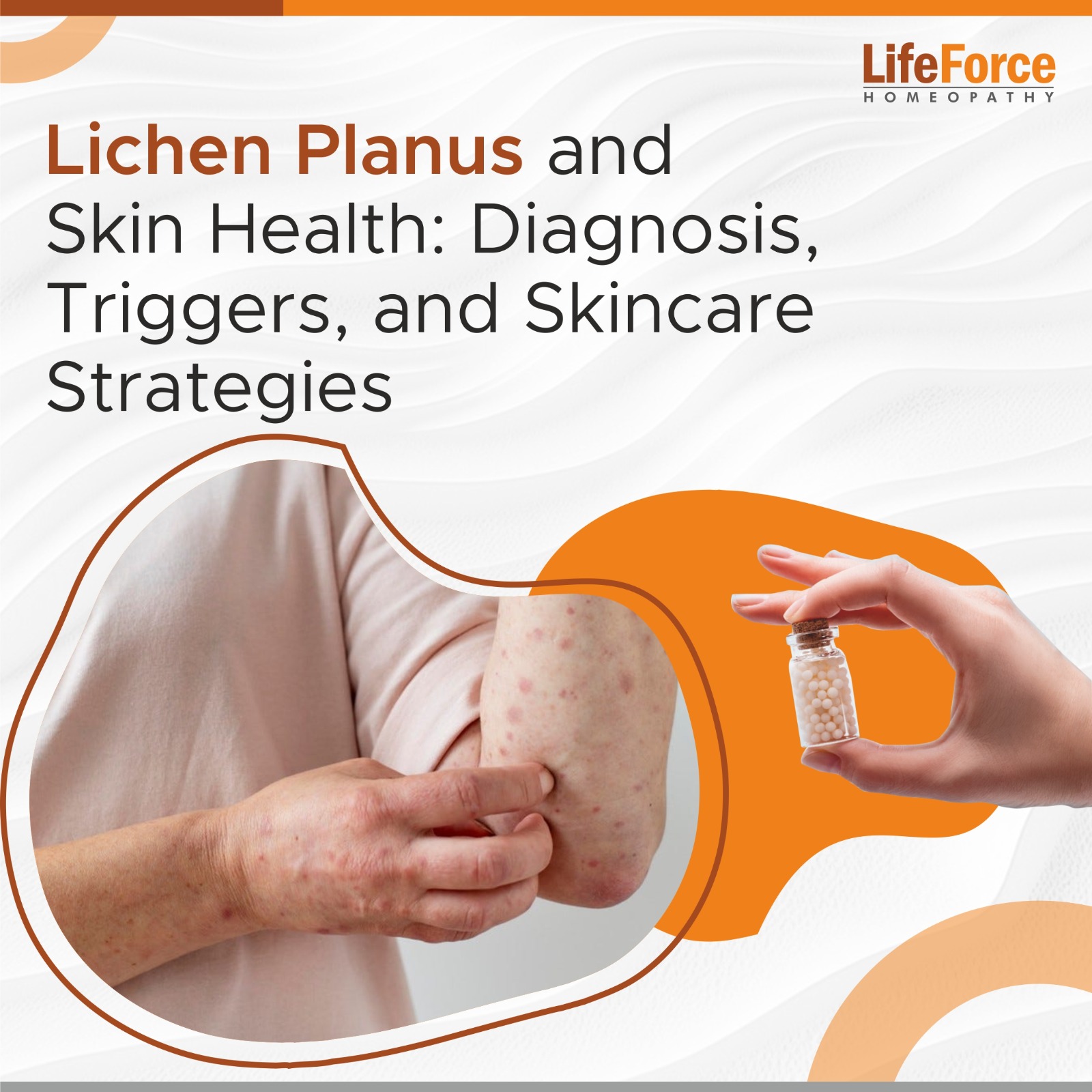 Lichen Planus Blog | Diagnosis, Triggers, and Skincare